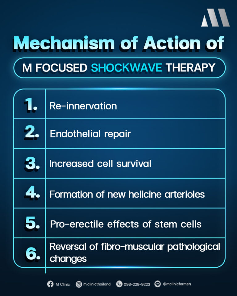 M Focused Shockwave - M Clinic Thailand