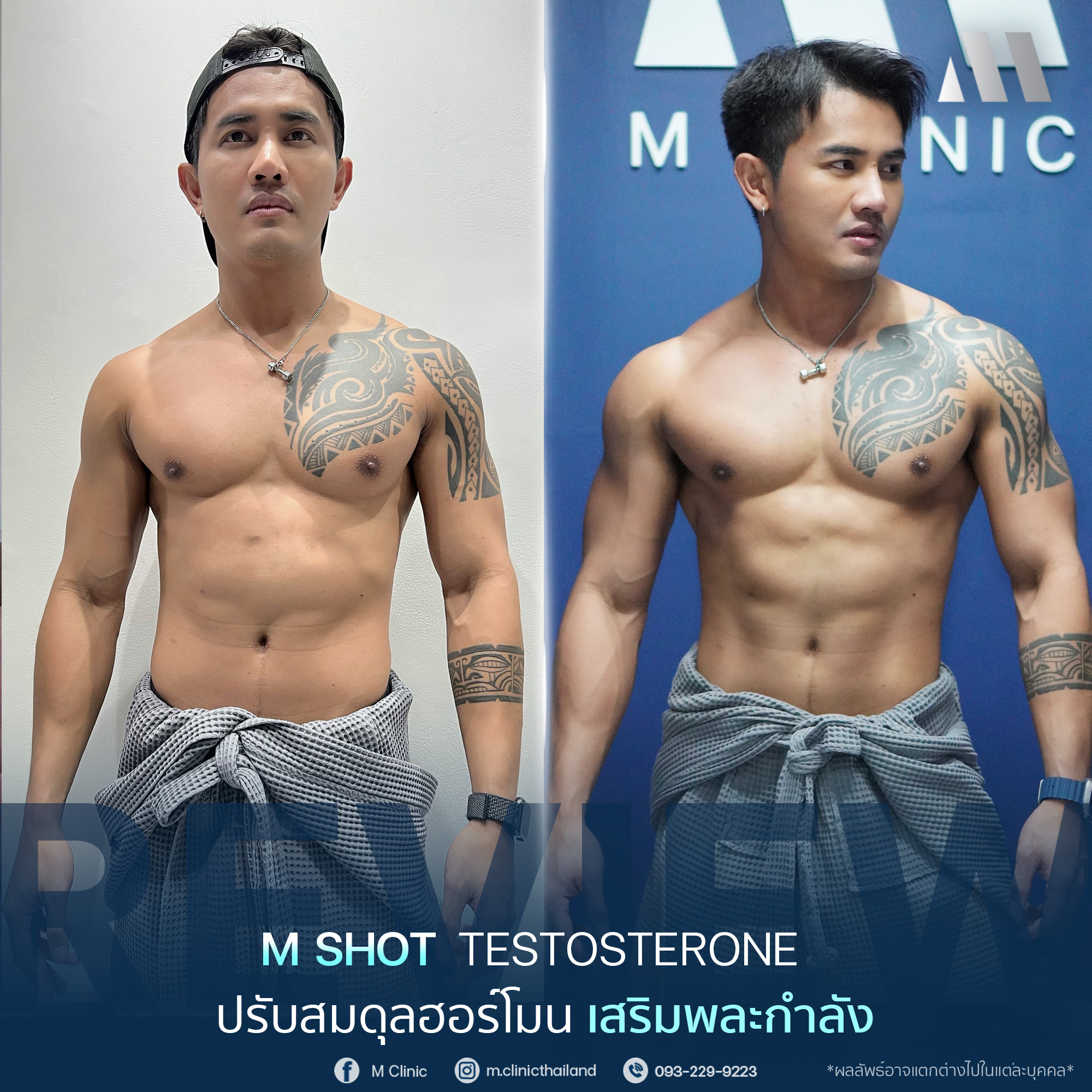 รีวิว M SHOT : TESTOSTERONE - M Clinic Thailand